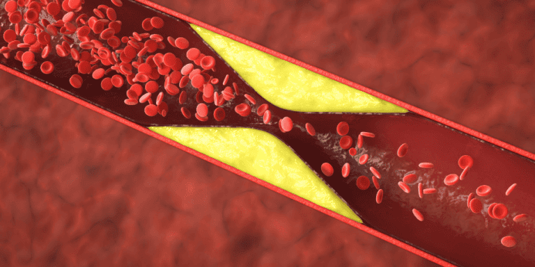 Burning Sensation in Legs: Causes and Remedies Explained