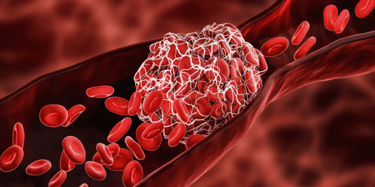 Bulging Veins in Legs: Identifying Causes & Treatment Options