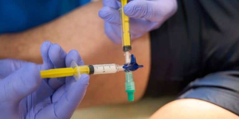6 Essential Sclerotherapy Aftercare Tips for Best Results