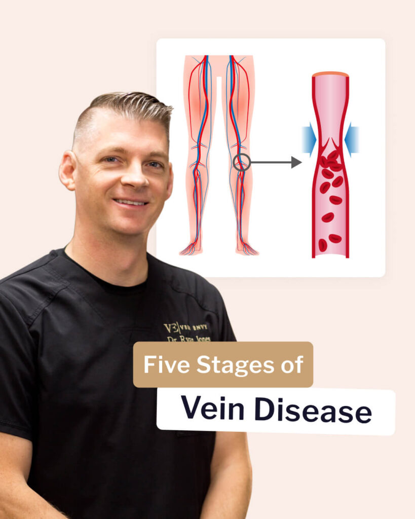 Vein Envy® - Top Rated Arizona Varicose & Spider Vein Clinic