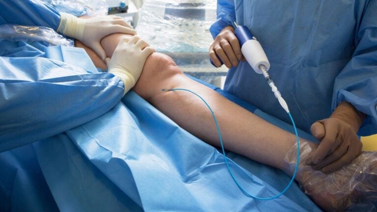 Vein Envy® - Top Rated Arizona Varicose & Spider Vein Clinic