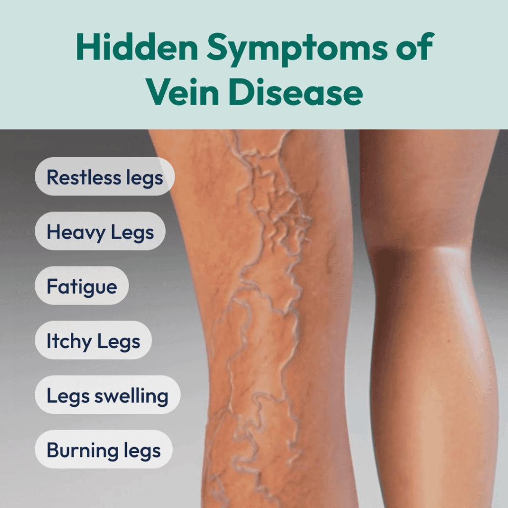 Free Vein Screening | Vein Envy® | Top Rated Vein Clinic