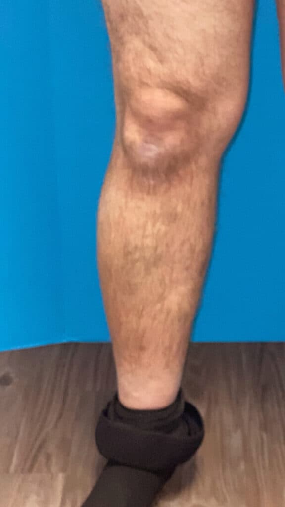 Free Vein Screening | Vein Envy® | Top Rated Vein Clinic