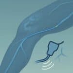 Vein Envy® - Top Rated Arizona Varicose & Spider Vein Clinic